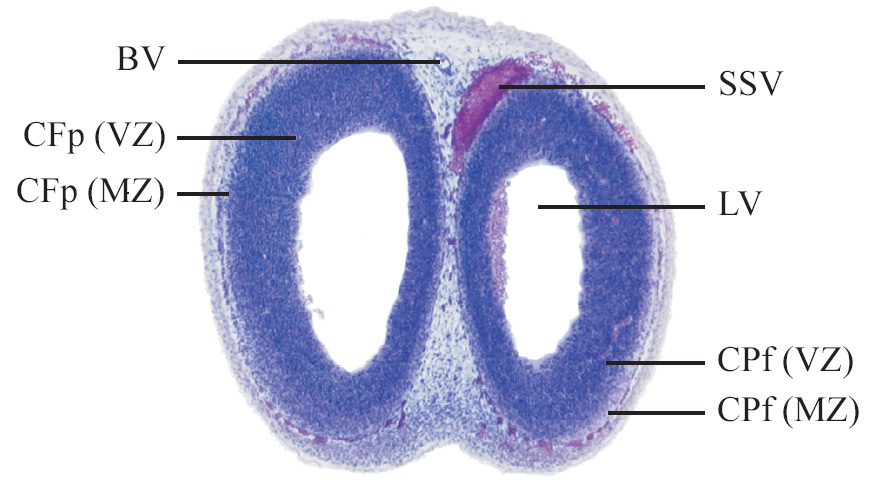 C57BL/6J GD12 Mouse Brain Atlas