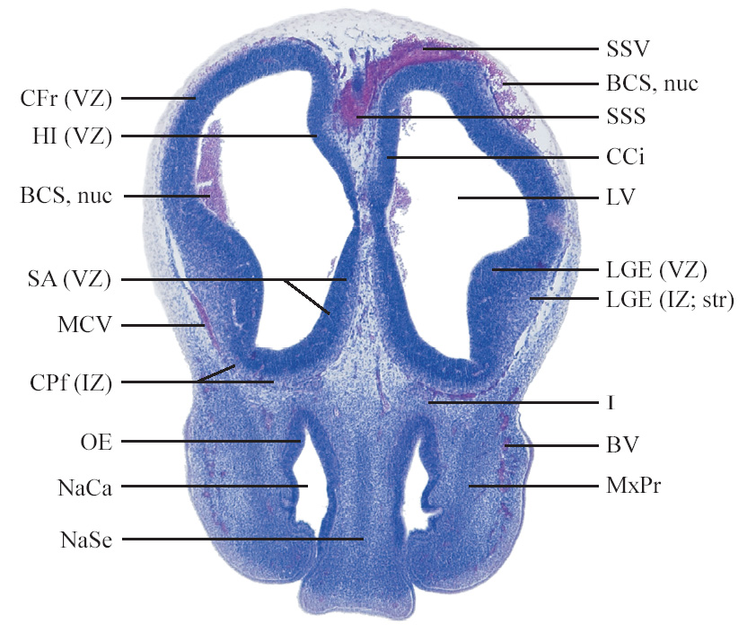 C57BL/6J GD12 Mouse Brain Atlas