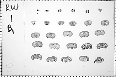 The Mouse Brain Library - Search the library