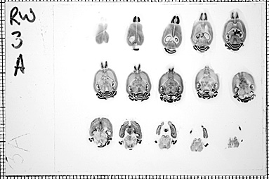 The Mouse Brain Library - Search the library