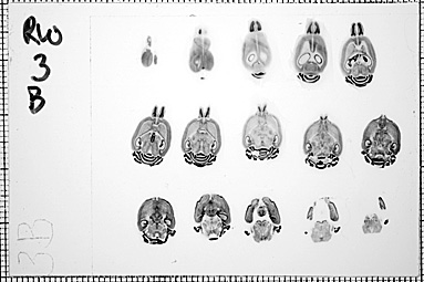 The Mouse Brain Library - Search the library
